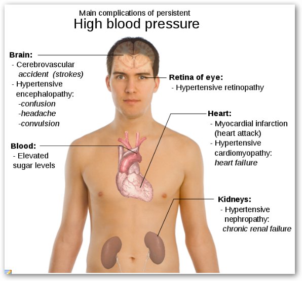 Hypertension Signs Symptoms Effects High Blood Pressure Vector ... Hypertension Signs Symptoms Effects High Blood Pressure Vector ...